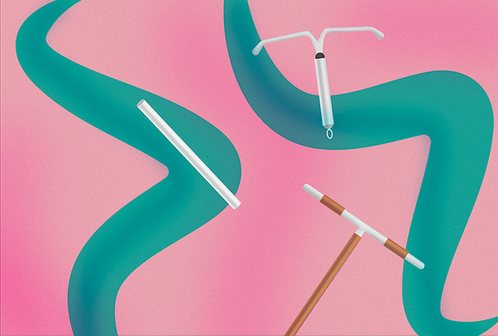 Doctor's Note: Your Long-Acting Reversible Contraception Options