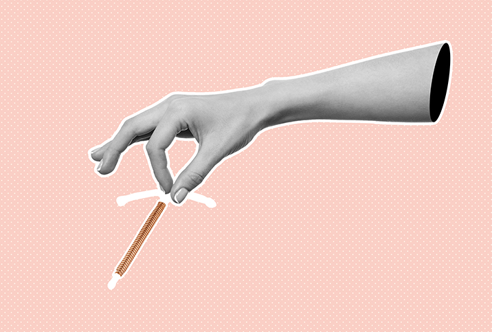 What Happens When Your IUD Falls Out?